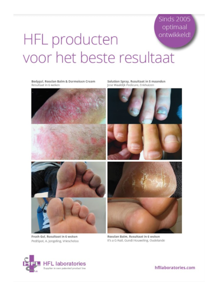 HFL Laboratories promomateriaal